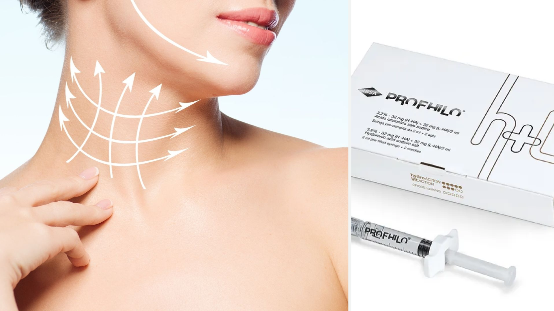 Profhilo - DRA. Angela Pedraza Dermatología